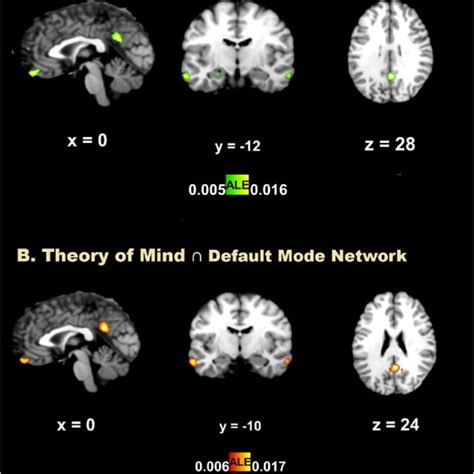 Conjunction Brain Activation Maps Of A Social Cognition And Default Download Scientific