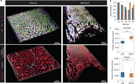 Vasculature Segmentation And Quantification In Bone Marrow With Download Scientific Diagram