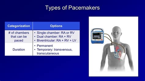 An Introduction To Pacemakers Youtube