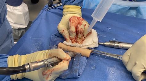 Orthopaedic Video Theater