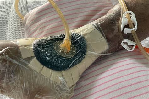 Negative Pressure Sergio Mazzei