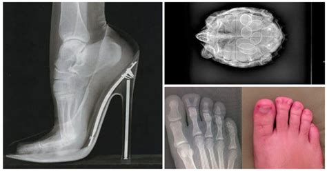 These 35 Bizarre X Rays Will Make You Scratch Your Head In Wonder