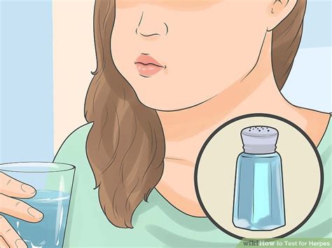 Ways To Test For Herpes WikiHow