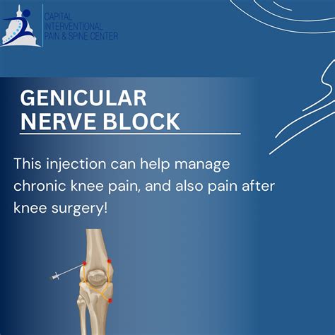 Akshay Garg Md Genicular Nerve Block A Targeted