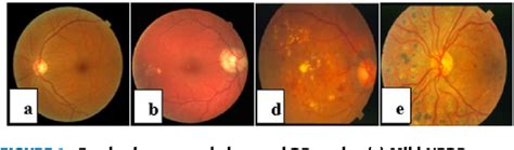 figure 1 from ensembled deep convolutional generative adversarial