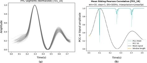Impact Of Sampling Rate And Interpolation On Photoplethysmography And