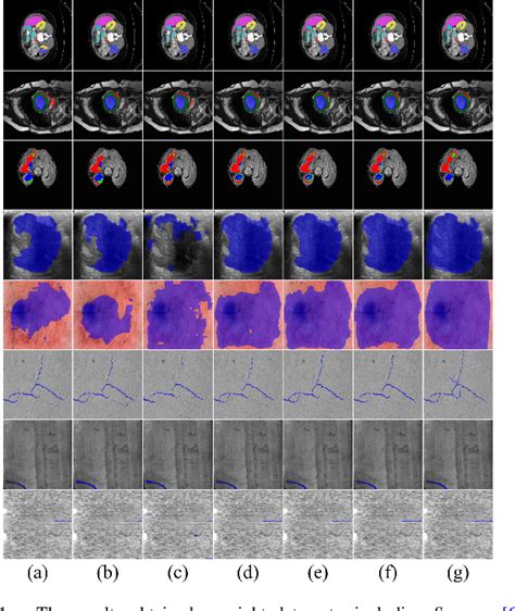 Figure 4 From Small Sample Image Segmentation By Coupling Convolutions And Transformers