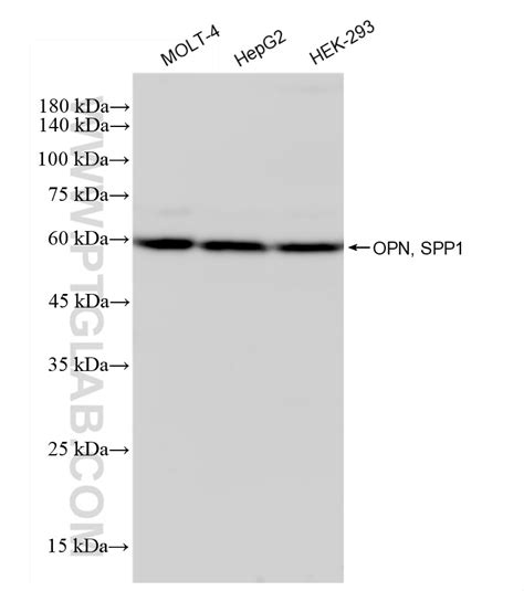 Osteopontin Antibody 83341 1 Rr Proteintech