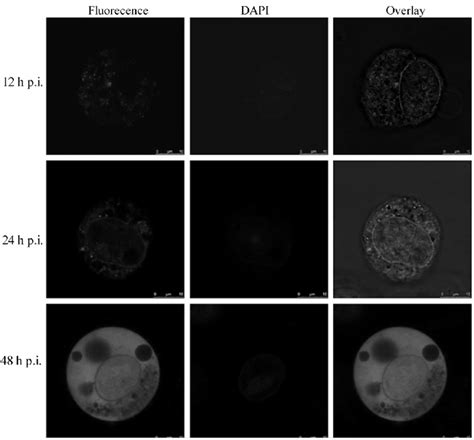 Intracellular Localization Of Swp Egfp Protein In Vbm Download