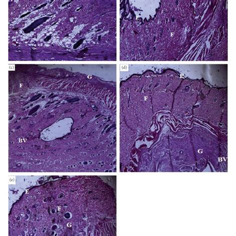 Sample Photomicrographs Showing Effects Of A Simple Ointment Bp B
