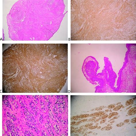 Pathological Slides Of Common Histopathological Variants Rate Above