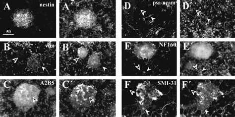 Unphosphorylated Class Iii Tubulin In Cns Neuroblast Cultures Download Scientific Diagram