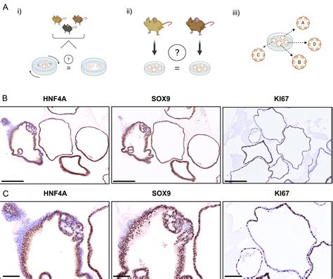 Rna Sequencing Of Single Cholangiocyte Derived Organoids Reveals High