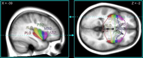 Frontiers Sex Differences In Insular Cortex Gyri Responses To The Valsalva Maneuver