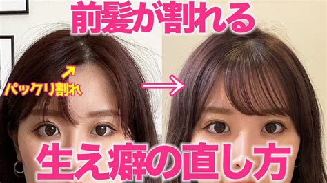 【前髪つむじ】割れる前髪を簡単に直す方法！これでもう前髪割れない！ Youtube