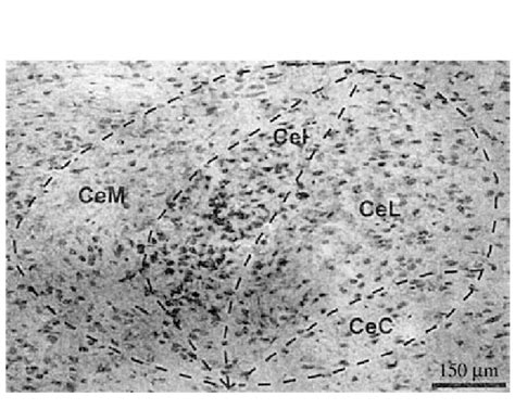 Frontal Section Of A Rat Brain Through The Central Nucleus Of The Download Scientific Diagram