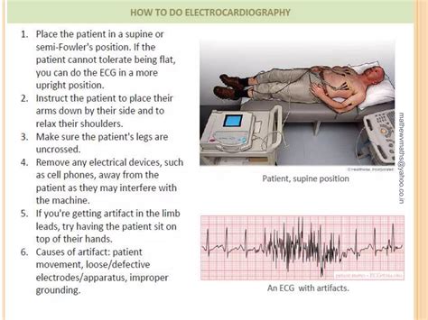 Cardiac Monitoring And Ecg Ppt