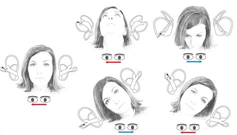 Minimum Stimulus Strategy For The Diagnosis Of Bppv Ent And Audiology News