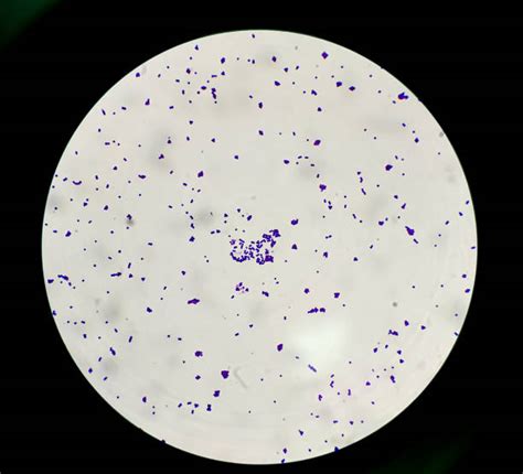Staphylococcus Saprophyticus Gram Stain