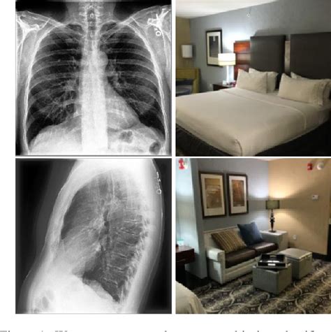 Figure 1 From Multi View Classification Using Hybrid Fusion And Mutual Distillation Semantic