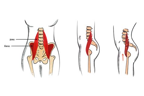 Anterior Pelvic Tilt The Meaningless Diagnosis Michael Braccio Dc Dacrb