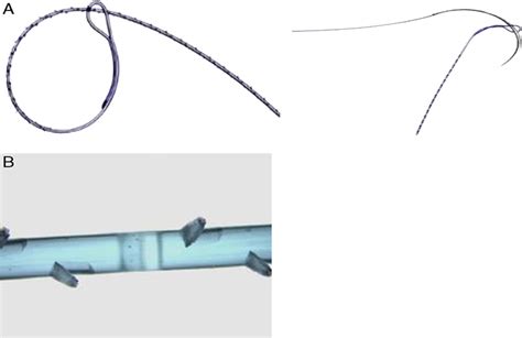 Laparoscopic Technique And Initial Experiences Of Choledocho Surgical Laparoscopy Endoscopy
