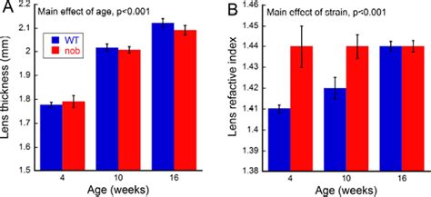 Figure 2 From Refractive Index Measurement Of The Mouse Crystalline Lens Using Optical Coherence