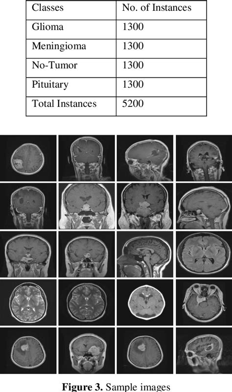 Figure 3 From Computer Aided Brain Tumor Diagnosis Using Coati