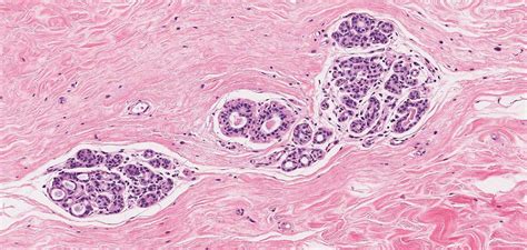 Stroma Pathology Dictionary MyPathologyReport Ca