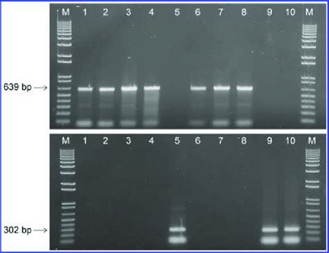 Mismatch Amplification Mutation Assay To Determine The G A Mutation Download Scientific