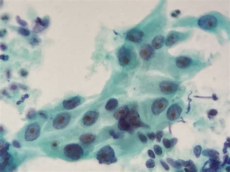 ブログ女性のデリケートゾーンのお悩みを解決するDrシイナラボ