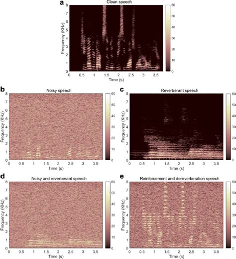 Spectrogram Comparison A Clean Speech B Noisy Speech Snr − 5 Db Download Scientific