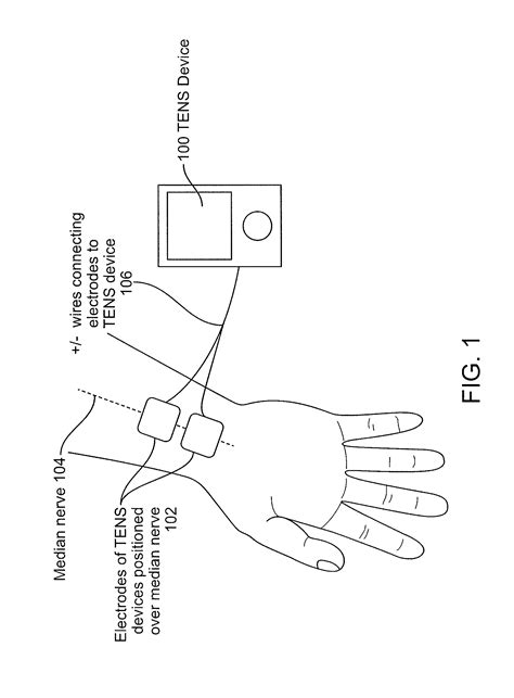 Essential Tremor Patented Technology Retrieval Search Results Eureka