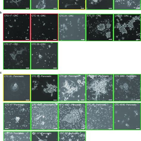 ctcs derived from multiple cancer types can be cultured representative download scientific