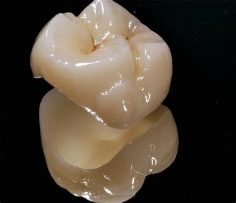 Cusp Of Carabelli Supernumerary Teeth Hyperdontia