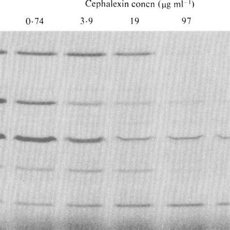 Inhibitory Effect Of Cephalexin On [14clpenicillin G Binding Envelopes Download Scientific