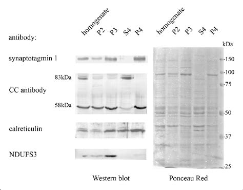 Adult Brain Subcellular Fractionation Immunochemical Profile Download Scientific Diagram
