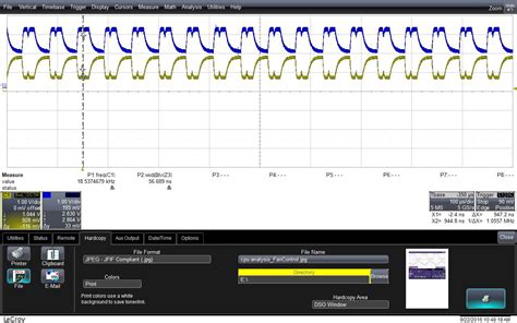 can error signals tms320f28377d interfaced with sn65hvd230qd