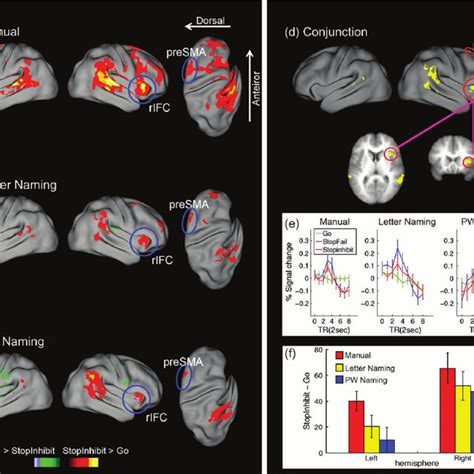 Pdf Common Neural Substrates For Inhibition Of Spoken And Manual Responses
