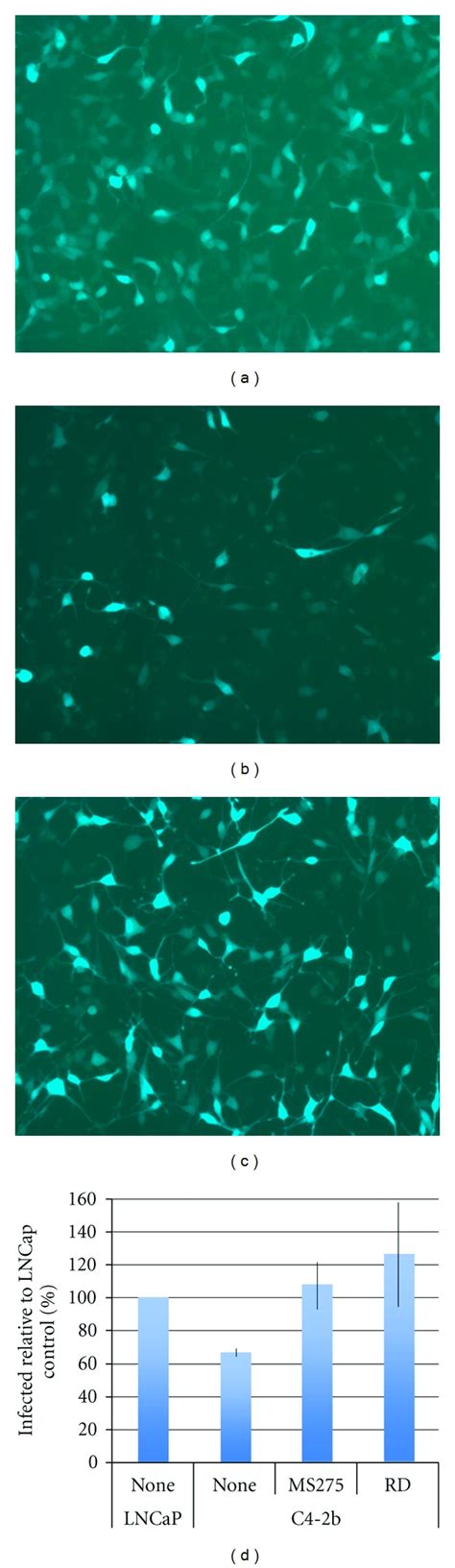 Analysis Of Gfp Expression By Fluorescence Microscopy And Download