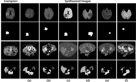 Synthesized Data Samples The Images Are Shown In The 1 St And 3 Rd Download Scientific Diagram