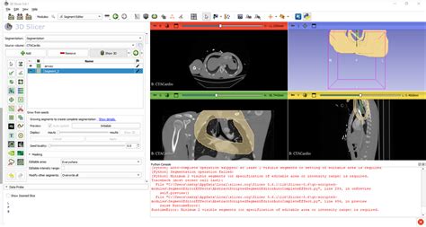 Grow From Seeds Error Minimum 2 Visible Segments Required Support