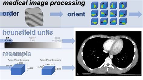 Downloading And Preprocessing Medical Images In Bulk Machine Learning Projects Learning