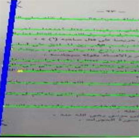 Boarders Detection Using Ransac Algorithm Download Scientific Diagram