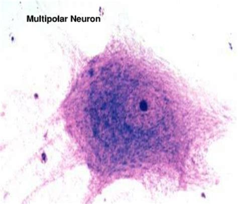 Multipolar Neuron Labeled Under Microscope