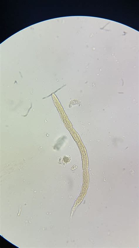 Pinworm Life Cycle Artofit