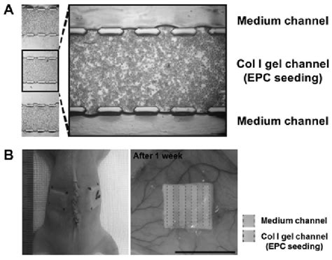 Implantation Of A Plga Microfluidic Device Seeded With Hepcs A Plga