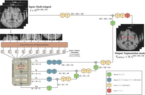 Architecture Of Vit Based Unetr Directly Connected To A Cnn Based