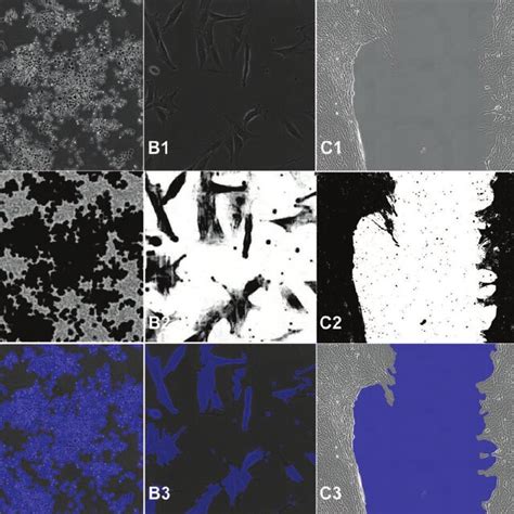 Original And Confidence Images As Well As Segmentation Masks For The