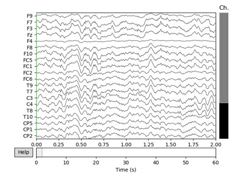 eeg pre processing and band pass filtering download scientific diagram